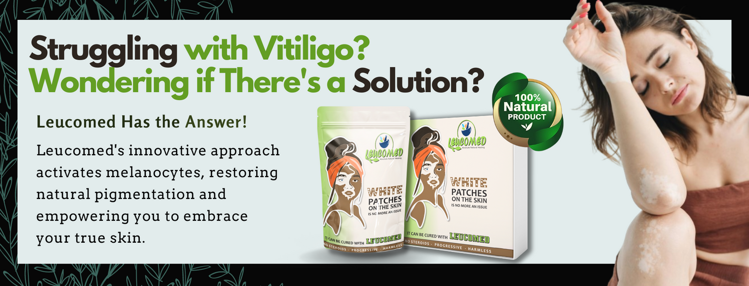 LVTS Leucoderma/Vitiligo Treatment System